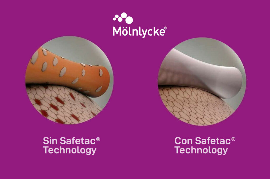 Qué es la tecnología Safetac - Mölnlycke